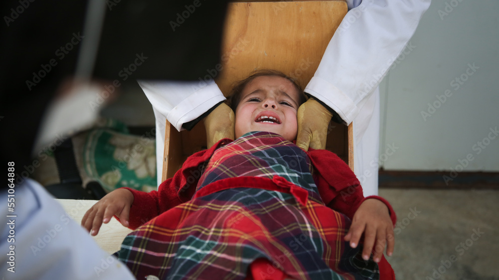 Doctor examines child malnutrition. Measuring malnutrition using strap ...