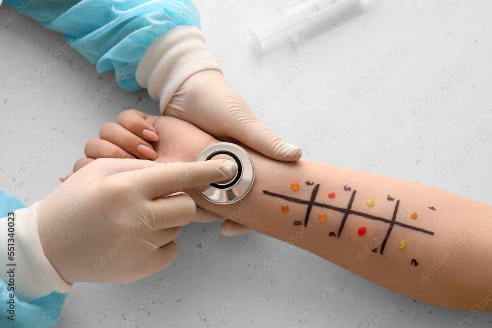 Doctor with stethoscope making allergy skin test on patient's hand in ...