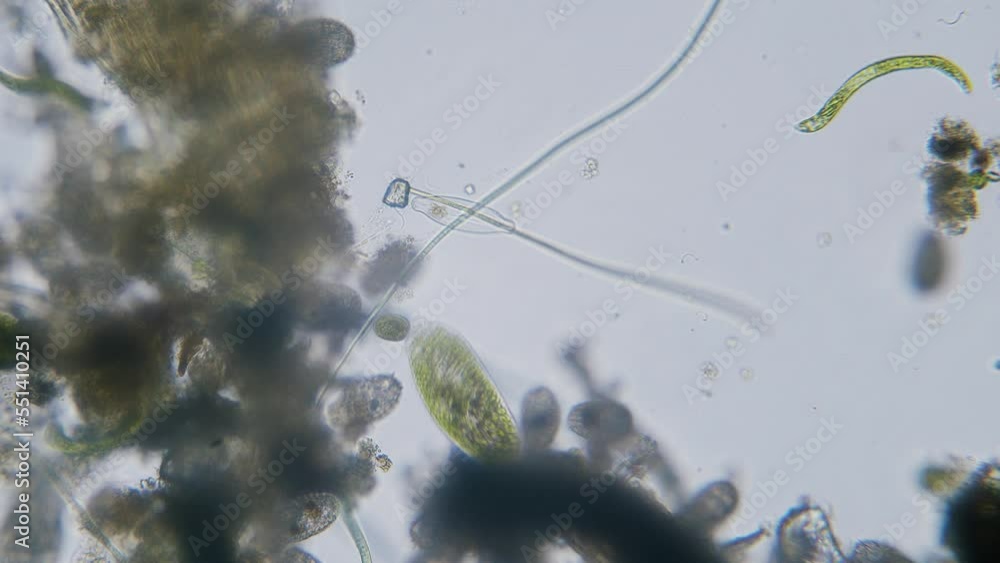Different freshwater species of protozoa single cell organisms as ...