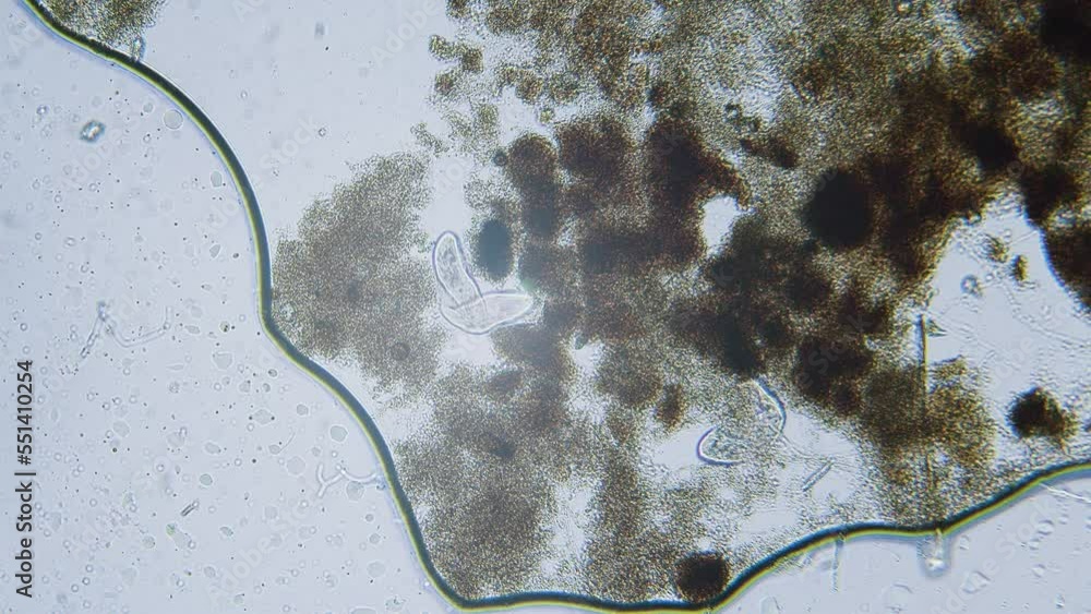 Different freshwater species of protozoa single cell organisms as ...