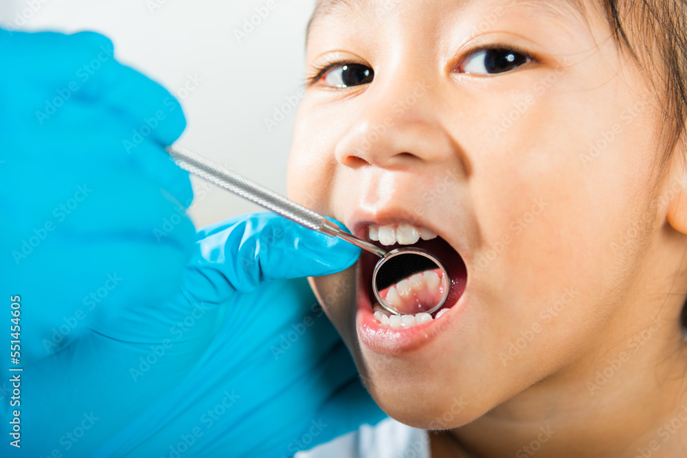 Dental kid health examination. Doctor examines oral cavity of little child uses mouth mirror to ...