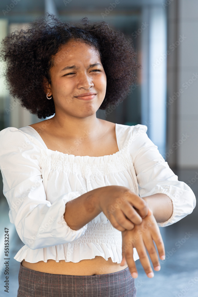 Irritating African woman scratching her hand skin, concept of dry skin ...