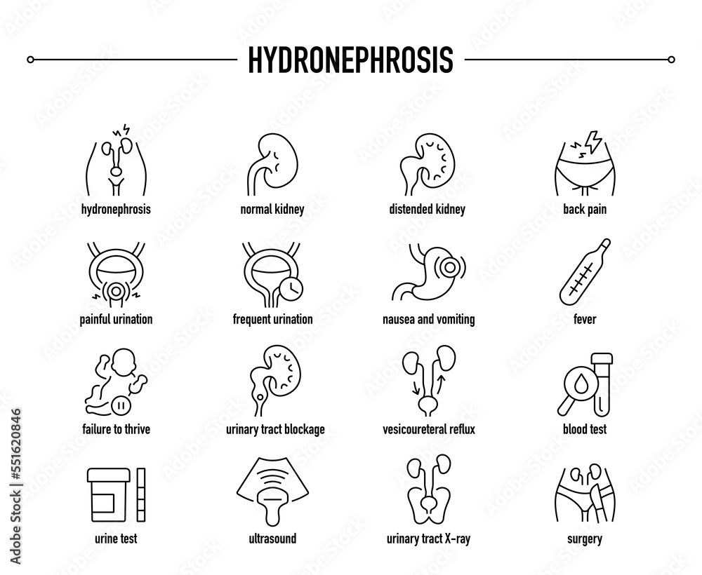 Hydronephrosis symptoms, diagnostic and treatment vector icon set. Line ...