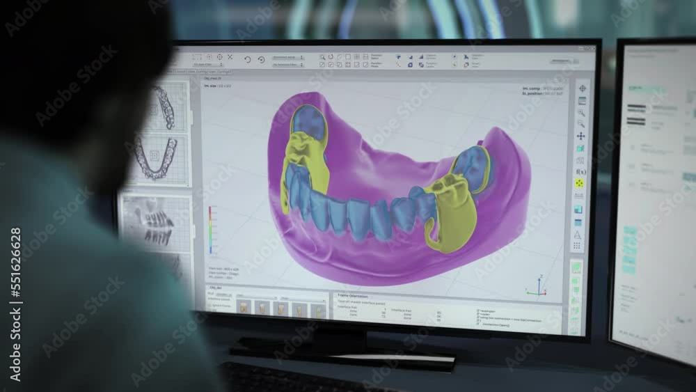 Computer application manufacturing the 3D prosthetic teeth model ...