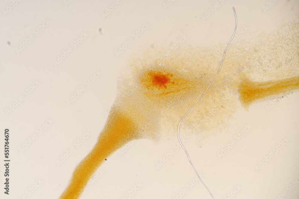 Slime molds, as a group, are polyphyletic under the microscope for ...