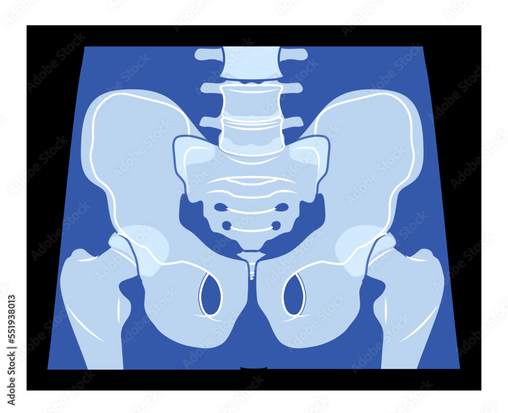 X-Ray pelvis Skeleton Hip Human body Bones adult people roentgen front ...