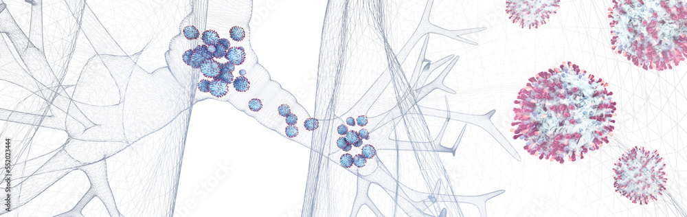 Respiratory syncytial virus (RSV) in the respiratory tract. The RSV ...