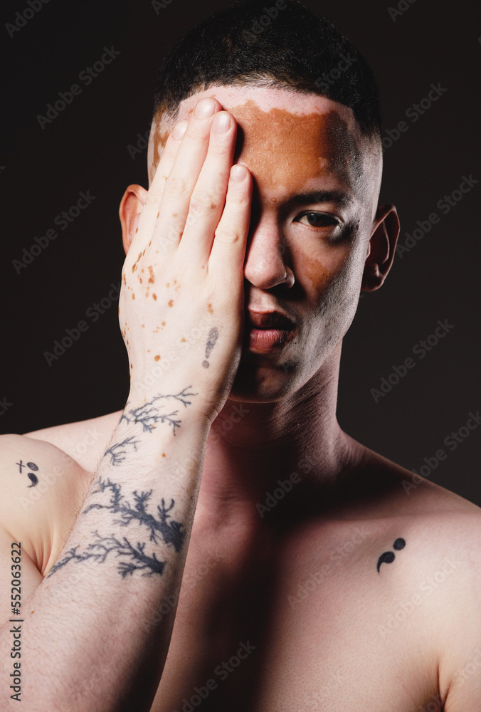 Man, vitiligo and beauty with hand, face and skincare portrait ...