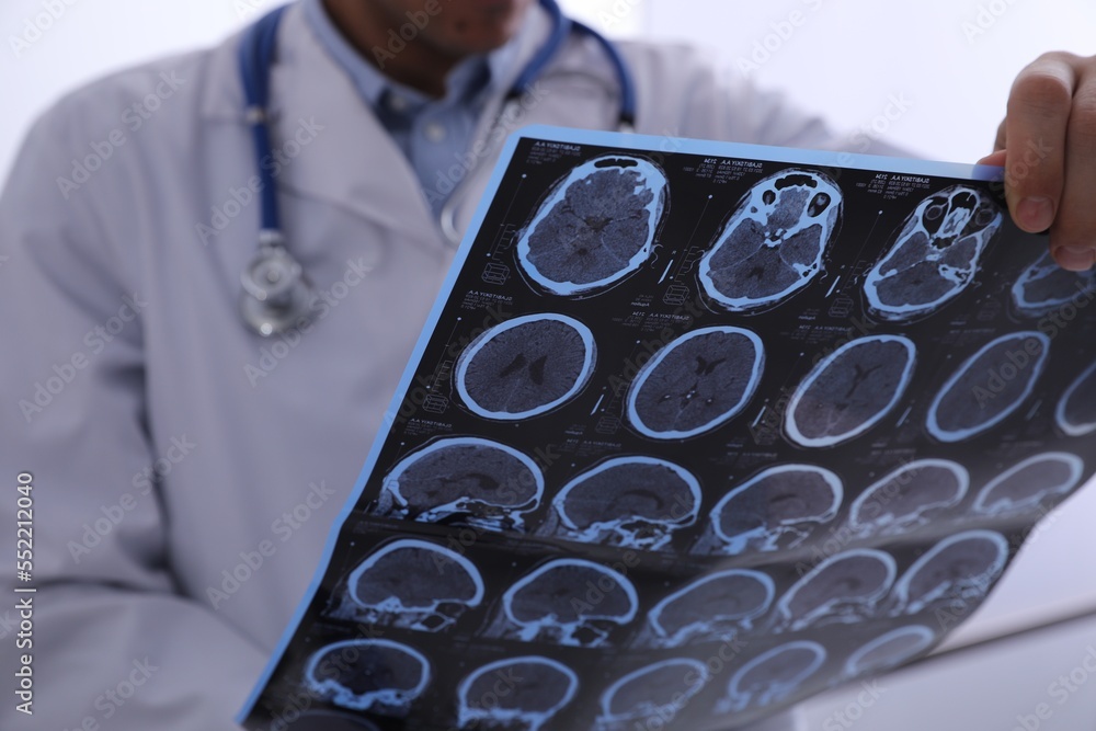 Poster Doctor examining MRI images of patient with multiple sclerosis ...
