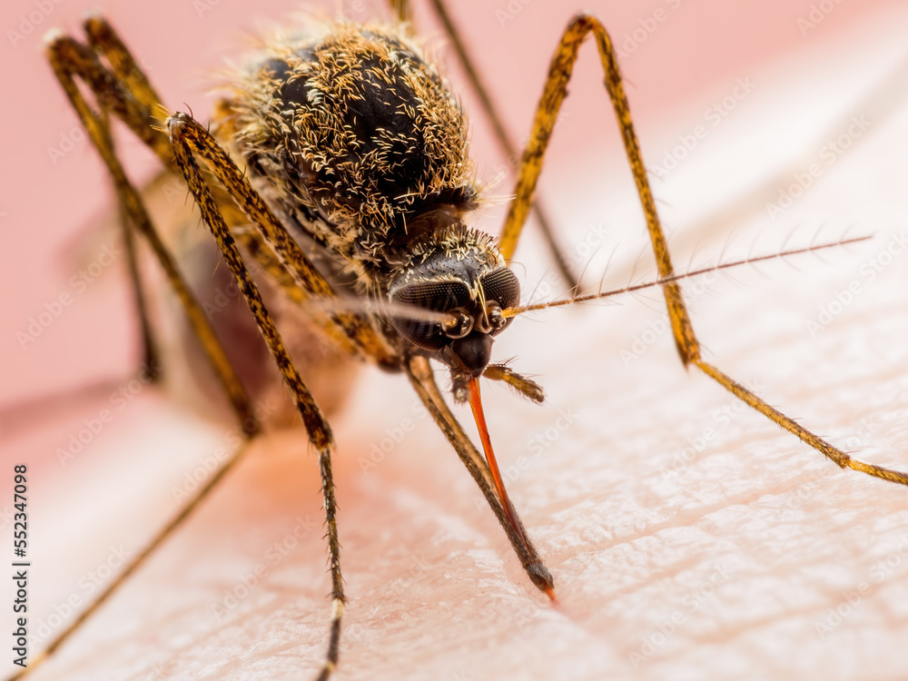 Malaria Infected Mosquito Bite. Leishmaniasis, Encephalitis, Yellow ...