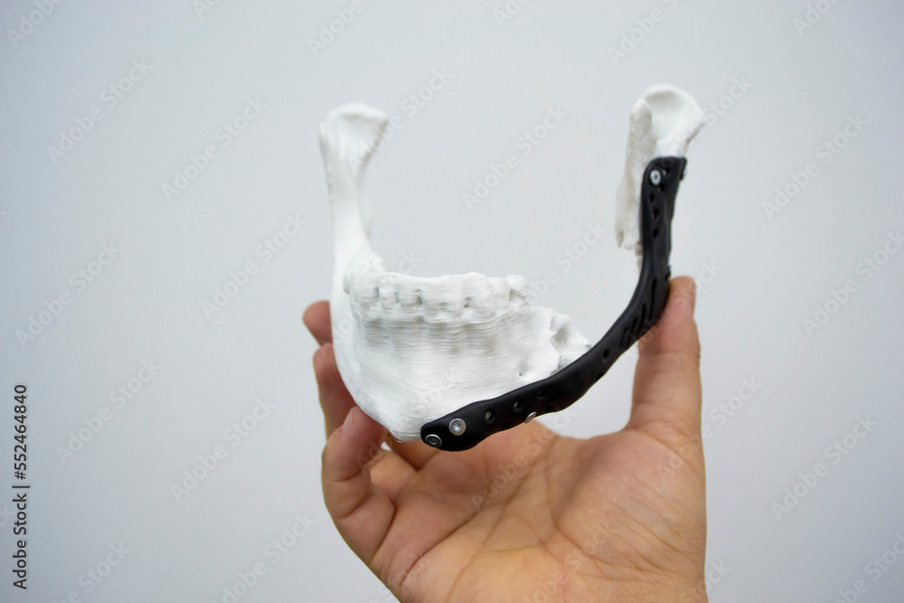 Person holding in hand 3D printed plastic prototype human lower jaw and ...