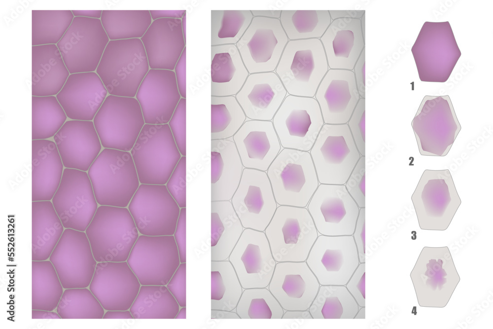 Plasmolysis in a plant cell. Process of contraction or shrinkage of the ...