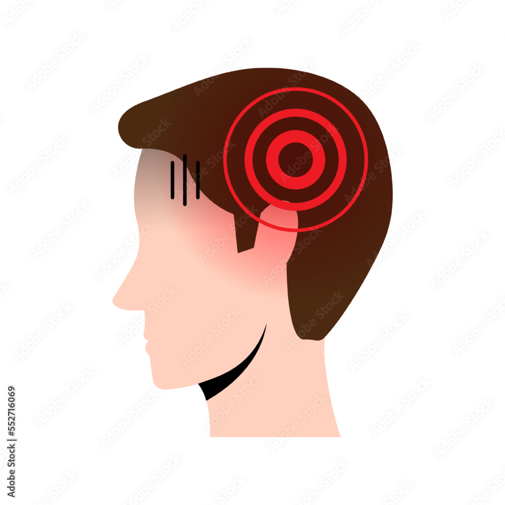 Man headache disease of the head migraine isolated stock vector eps10 ...