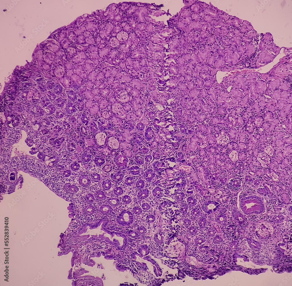 Light micrograph of wall of the small intestine (duodenum) showing ...
