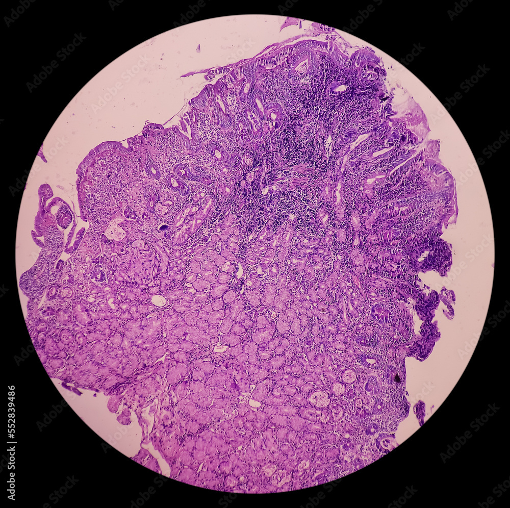 Light micrograph of wall of the small intestine (duodenum) showing ...