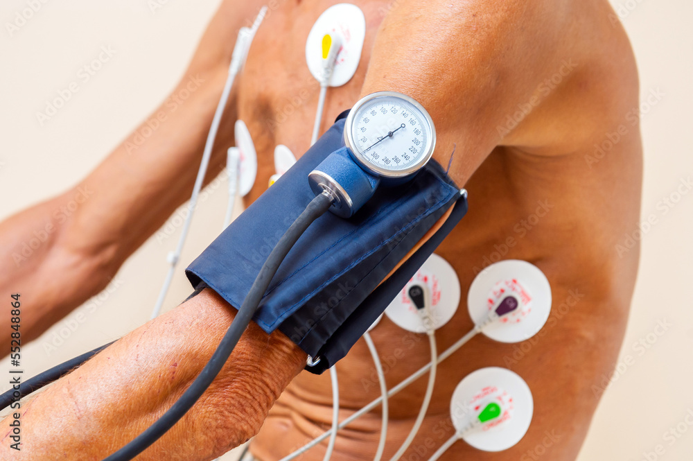 Electrocardiogram, ECG in hand. Clinic of Cardiology heart rate and ...