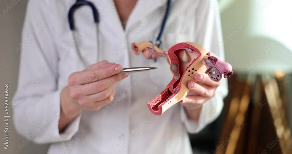 Doctor gynecologist shows an anatomical model of uterus and ovaries ...