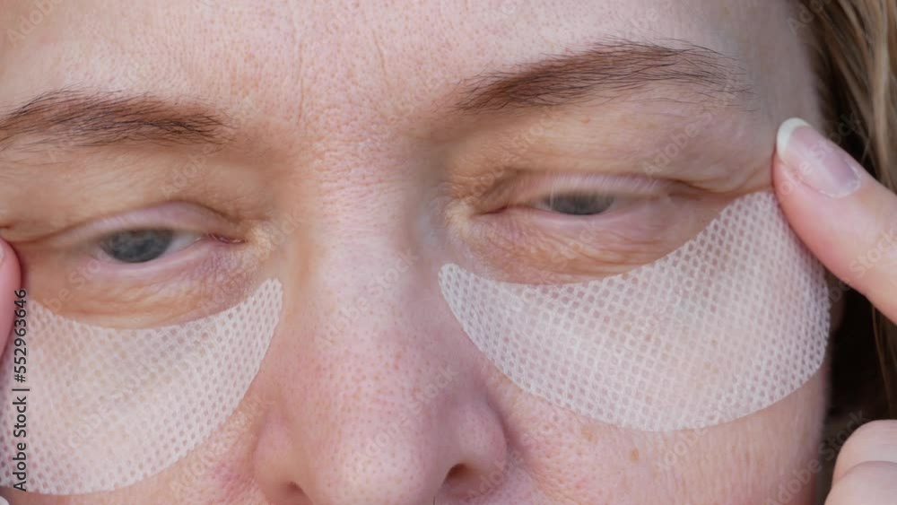 middle aged female's eye with drooping eyelid with patch for eyes ...