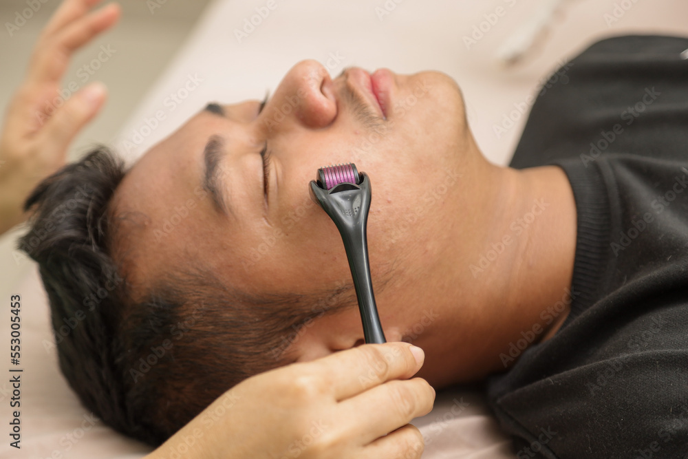 Asian teenage boy doing mesotherapy procedure. Facial microneedling ...