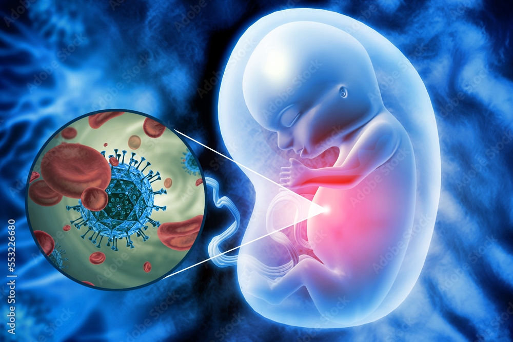 Infectious Disease 3d