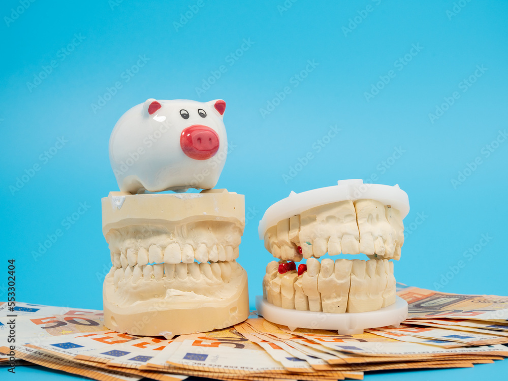 Dental casts, piggy bank and banknotes on a blue background. Plaster ...