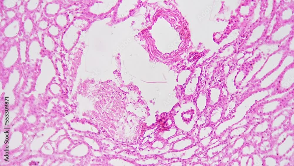Section of human kidney section filmed under light micrograph 200x on ...