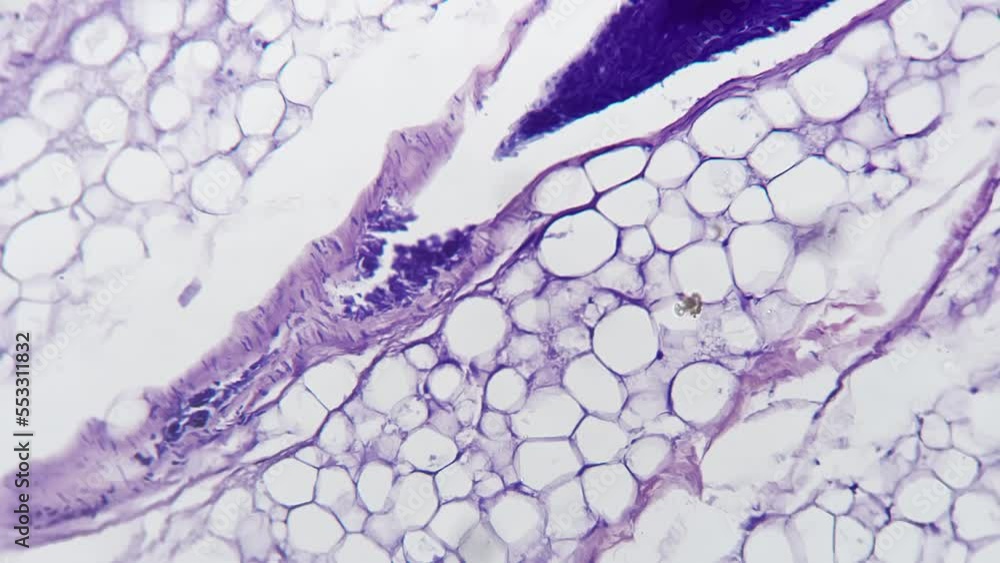 Adipose human tissues in section magnified under light micrograph 200x ...