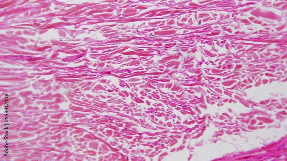 Human skin in section magnified under light microscope in 200 times ...