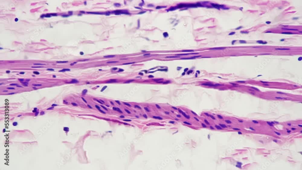 Stratified squamous epithelium in section is filmed under microscope ...