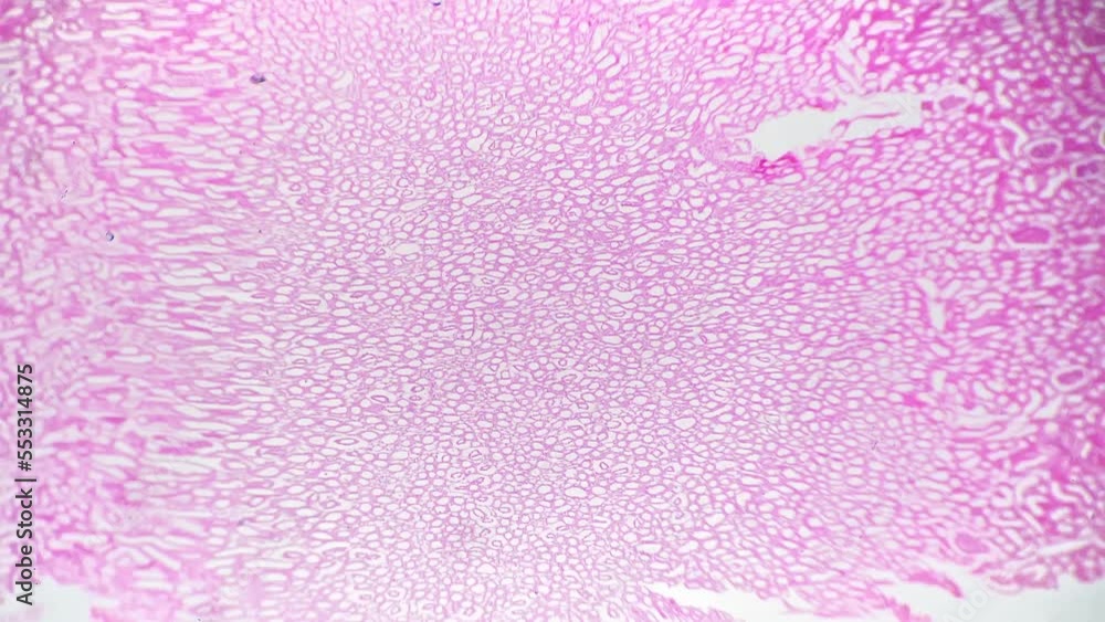 Human kidney tissue is magnified in 40 times under microscope and ...