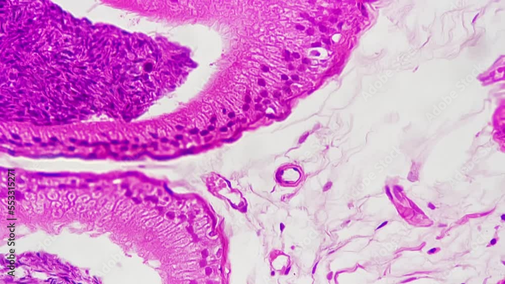 Macro view of epididymis in section under microscope magnified in 400 ...