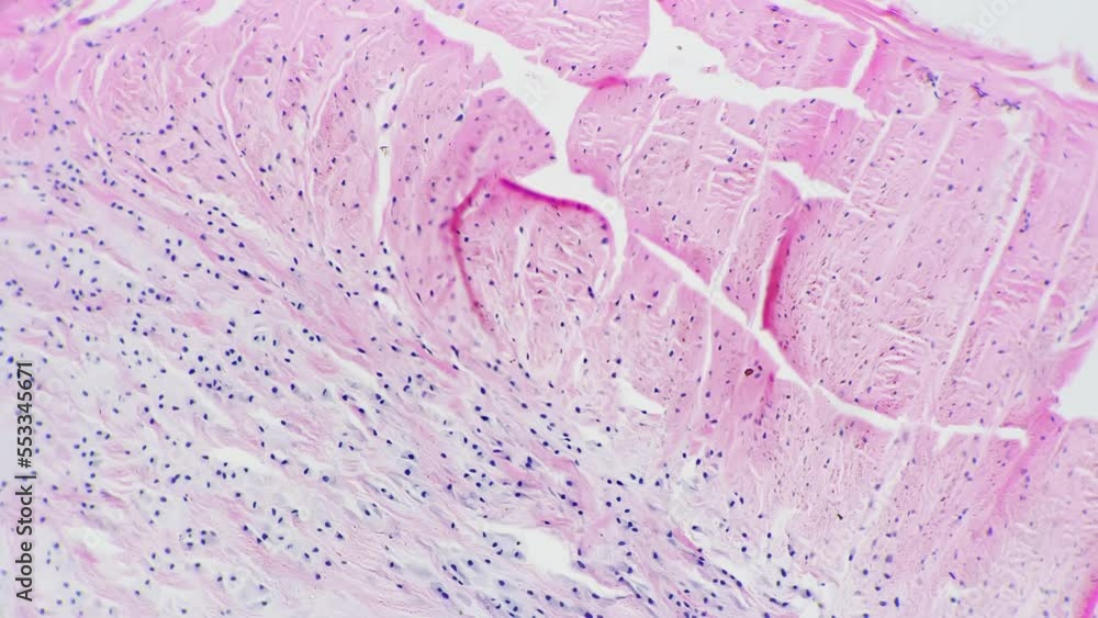 Cross section of teased human tendon magnified under microscope 100x on ...