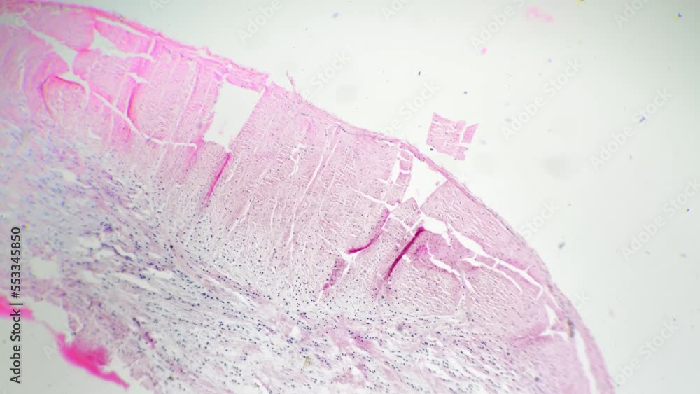 Teased human tendon in cross section filmed under microscope 40x on ...
