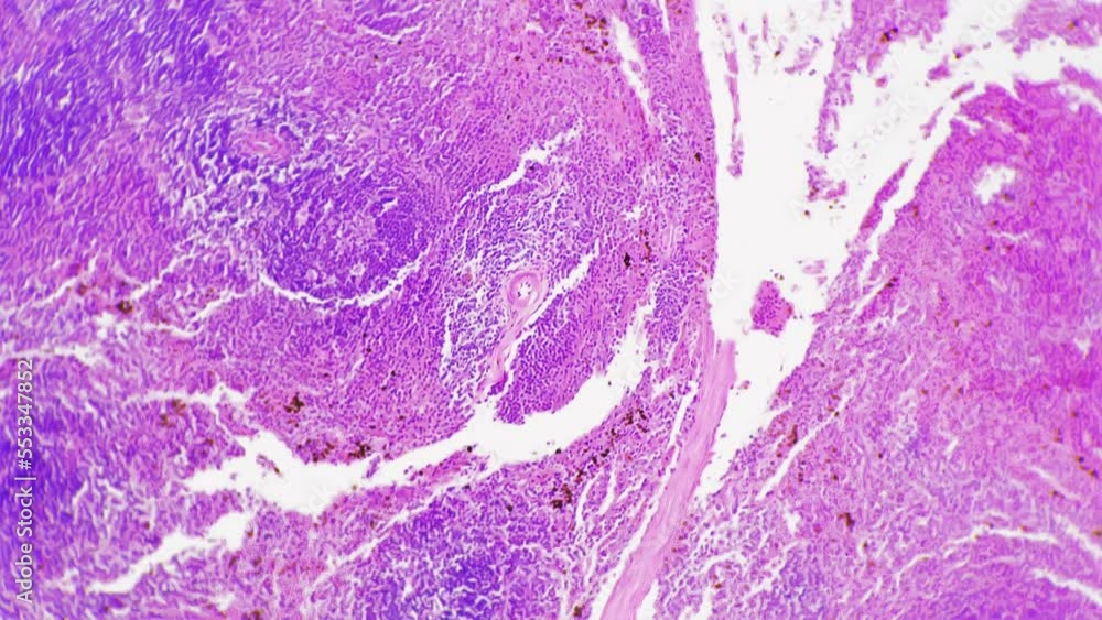 Piece of human spleen is section taken and magnified in laboratory ...