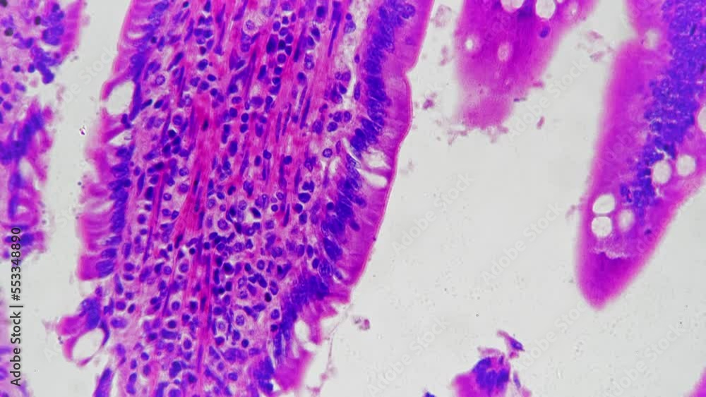 Small human intestine in cross section magnified under microscope 400x ...