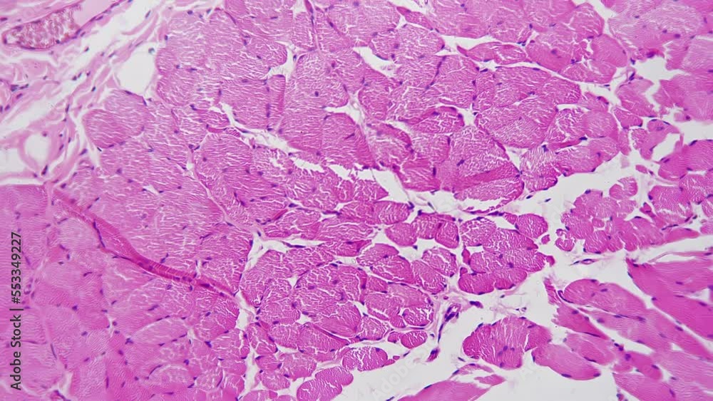 Oesophagus of in transversal section magnified in 200 times under ...