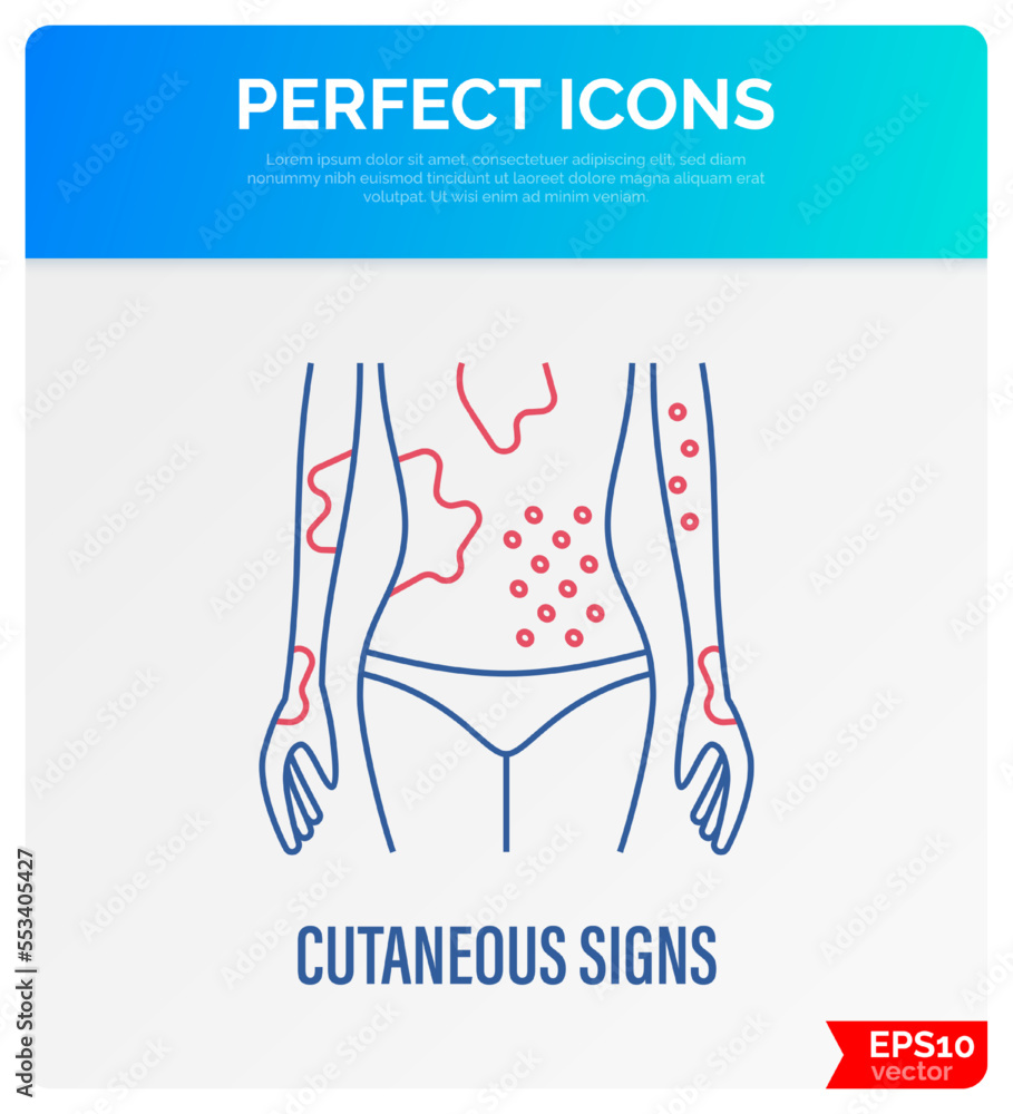 Dermatology. Dermatitis, allergy, rash, hives on body. Thin line icon ...