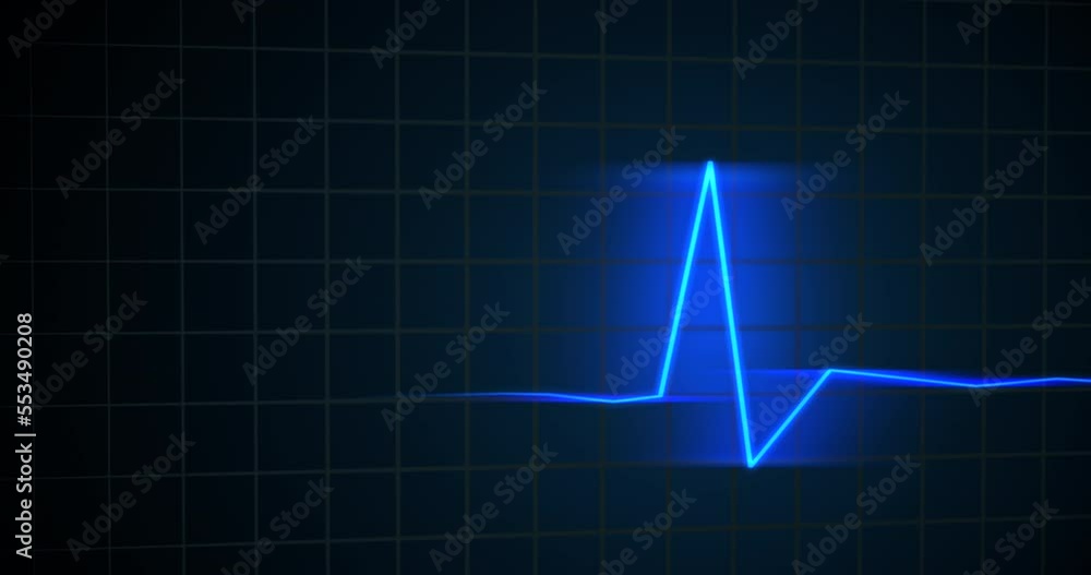Heartbeat monitor animation. A smooth animation in high quality on a ...