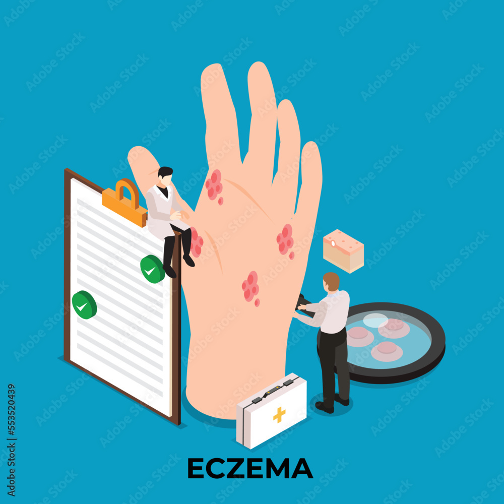 Eczema skin disease isometric 3d vector illustration concept for banner ...
