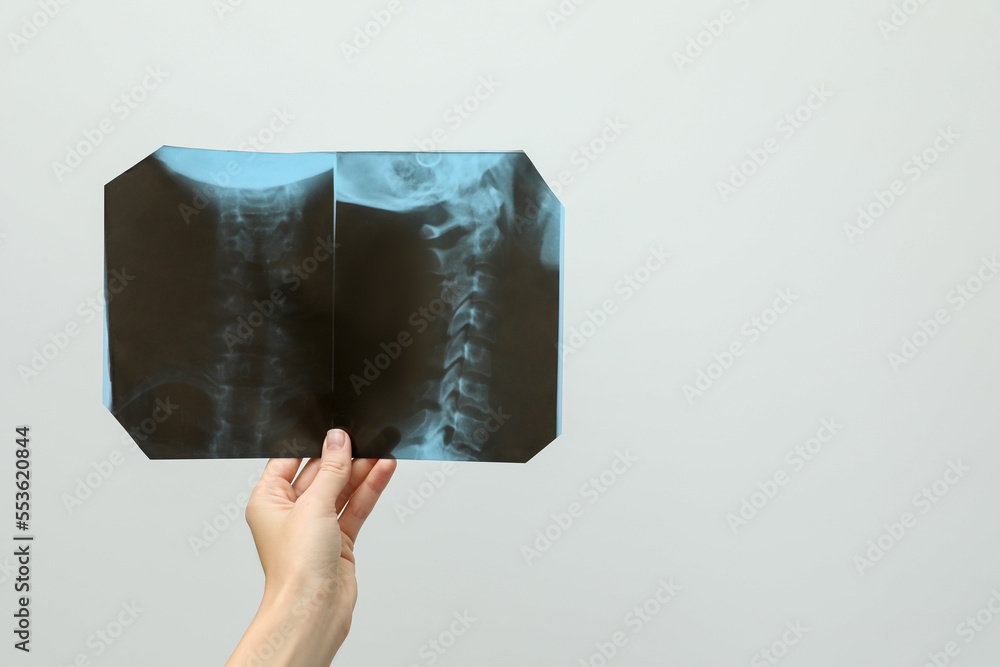 Doctor examining neck MRI image on light grey background, closeup ...