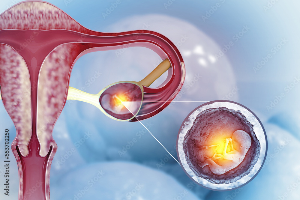 Fertilized Egg In Uterus