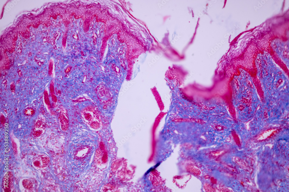 Developing of nail, human embryo under the microscope in Lab. Stock ...