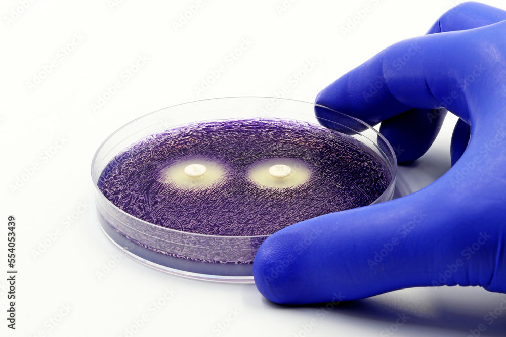 Antibiotic sensitivity or resistance test in a microbiological culture ...