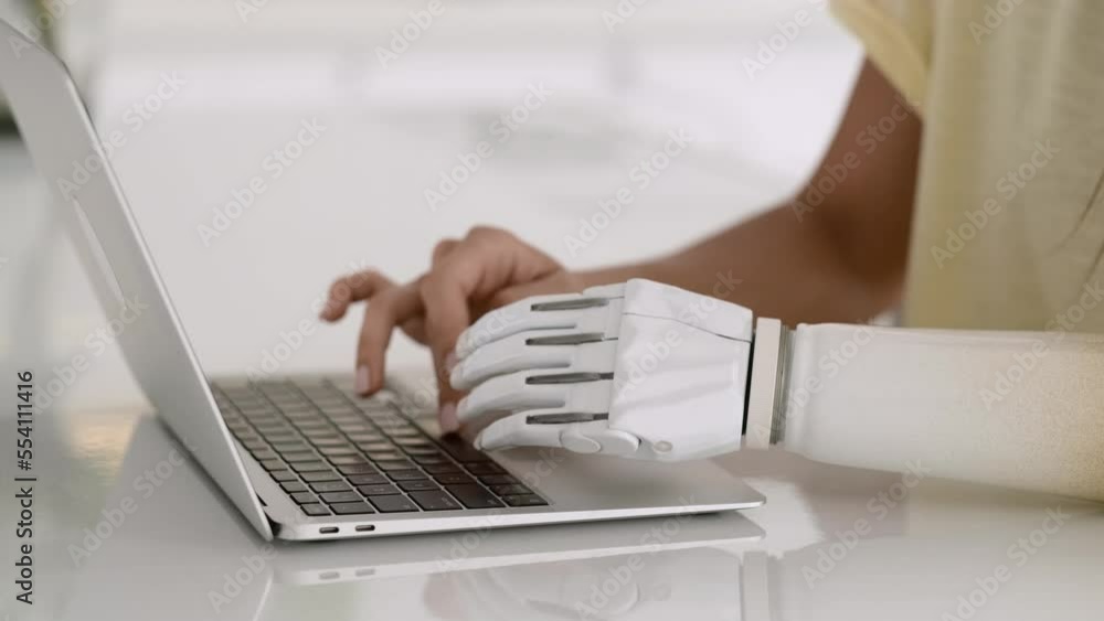Motivated woman using prosthetic arm working or learning notebook ...