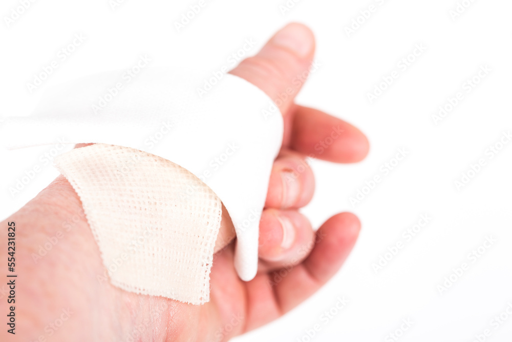 chemical burn on the wrist skin with hydroxide sodium acid. Household ...