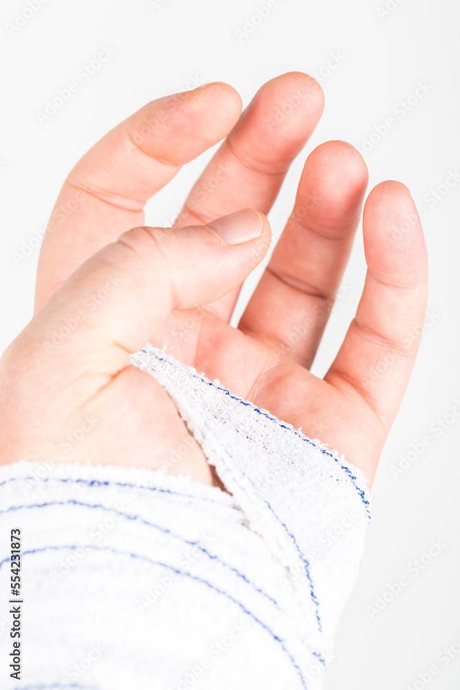 chemical burn on the wrist skin with hydroxide sodium acid. Household ...