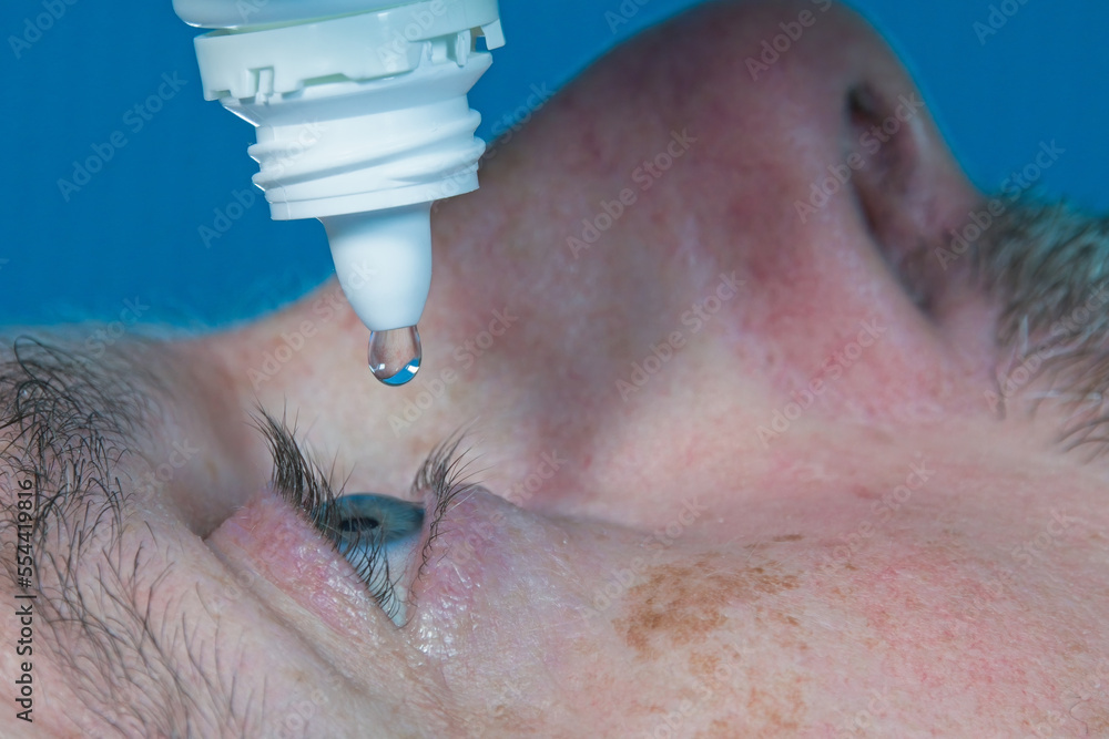 Eye drops being administered to a patient, with a close up view ...