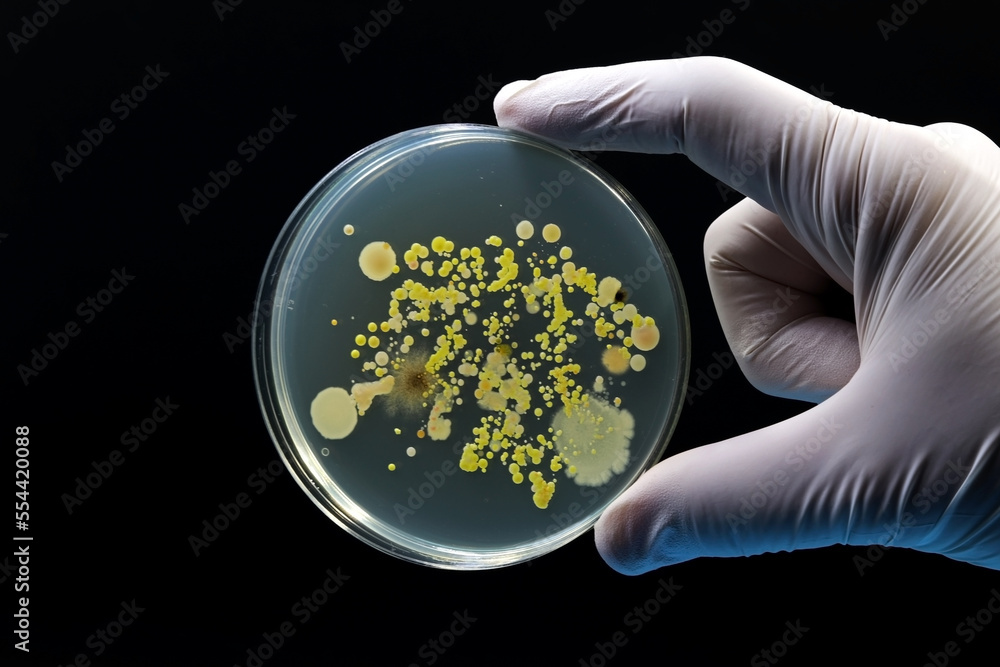 Doctor's or scientist's hand holding a microbiological culture Petri dish with different species ...