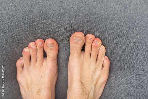 Dirty toes Images - Search Images on Everypixel