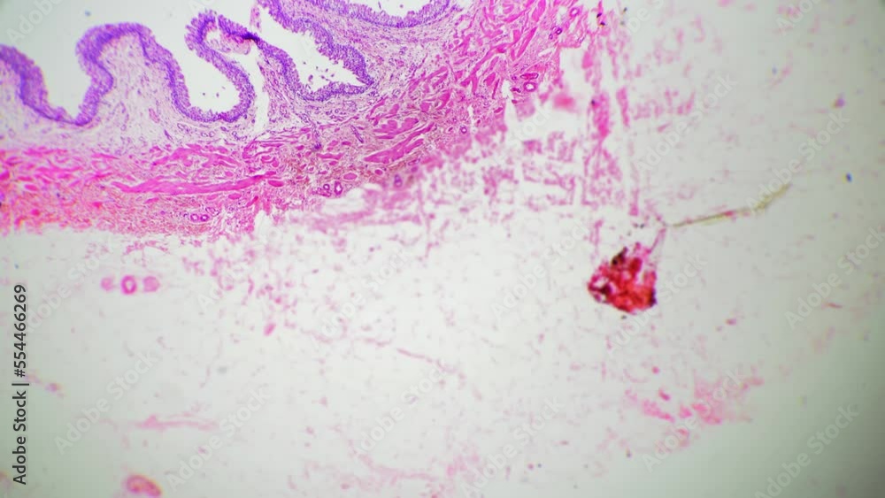 Human urethra in section with 100 magnification filmed under microscope ...